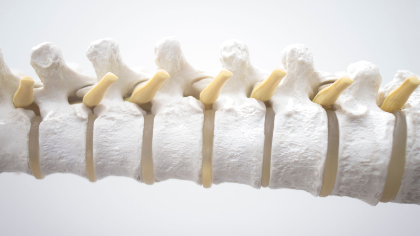 Σπονδυλοπλαστική – Κυφοπλαστική