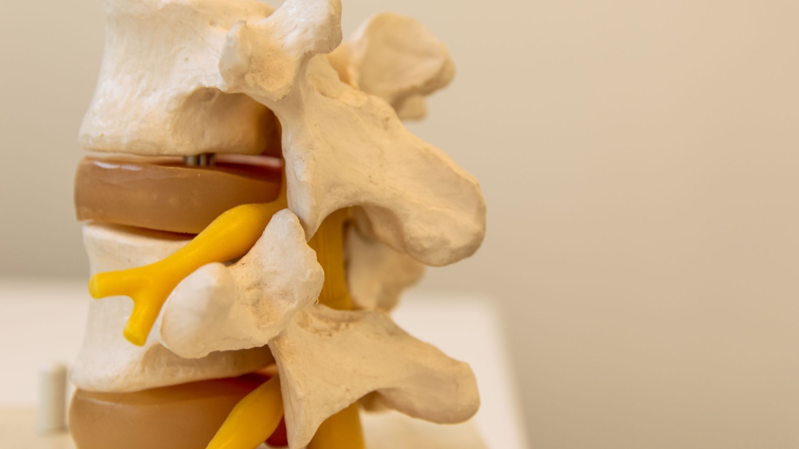 Σπονδυλοδεσία